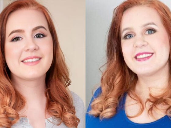 Scarlett Madison Biography, Husband, Age, Net Worth and More